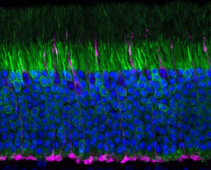 Mouse Retina Showing Rods and [IMAGE] | EurekAlert! Science News Releases