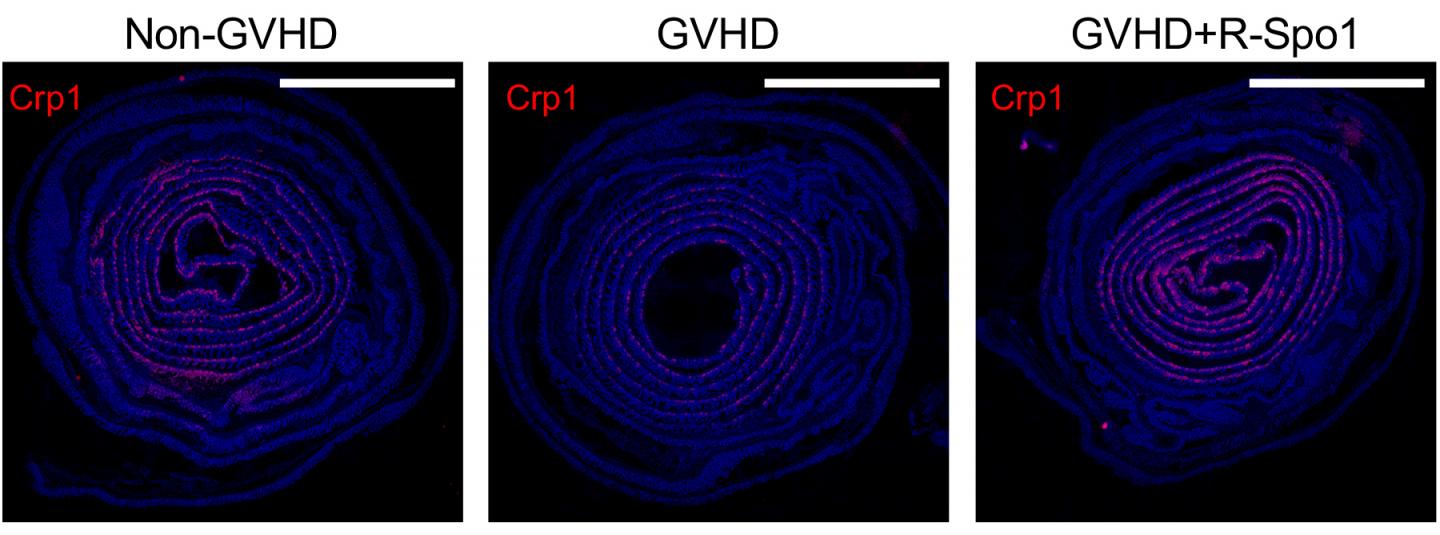 R-Spondin1 Protects Paneth Cel [IMAGE] | EurekAlert! Science News Releases