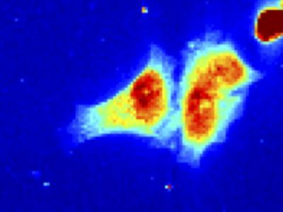 X-ray Scan of a Biological Cel [IMAGE] | EurekAlert! Science News Releases