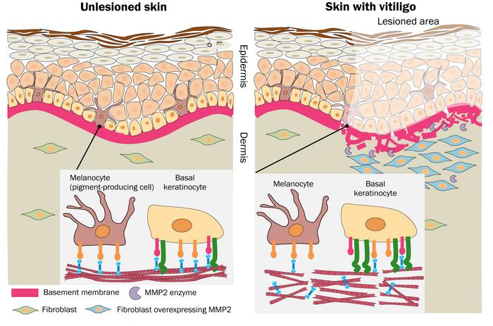Disappearance of pigment-produ [IMAGE] | EurekAlert! Science News Releases