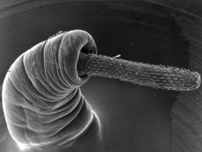 Echinorhynchid acanthocepha [IMAGE] | EurekAlert! Science News Releases