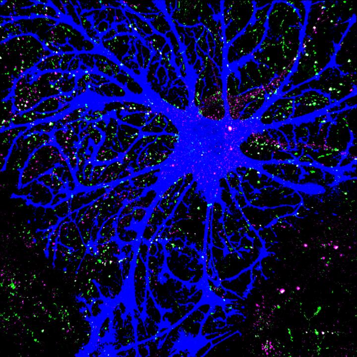 Astrocyte [IMAGE] | EurekAlert! Science News Releases