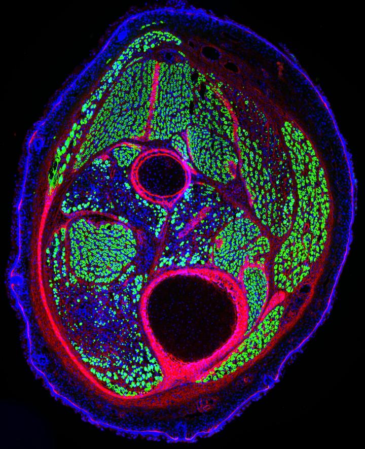 Developing Muscle in a Mouse L [IMAGE] | EurekAlert! Science News Releases