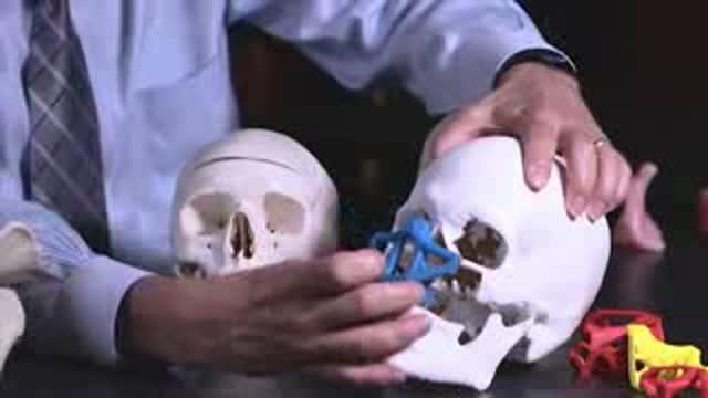 Medicine and Engineering Join Forces to Resto | EurekAlert!