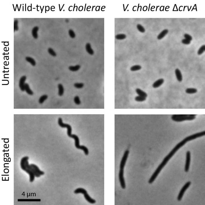 Vibrio Cholerae Microscope
