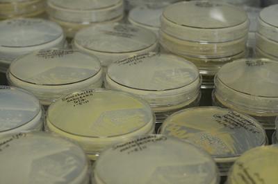 Bacteria Carried as Weapons? [IMAGE] | EurekAlert! Science News Releases