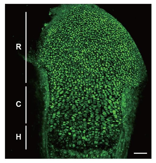 How Does Calcium Signaling Guide Proper Bone | EurekAlert!