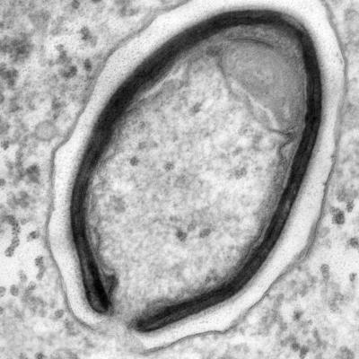 Supersized Viruses Break Recor [IMAGE] | EurekAlert! Science News Releases