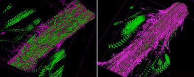 Fibrotic Fly Heart [IMAGE] | EurekAlert! Science News Releases