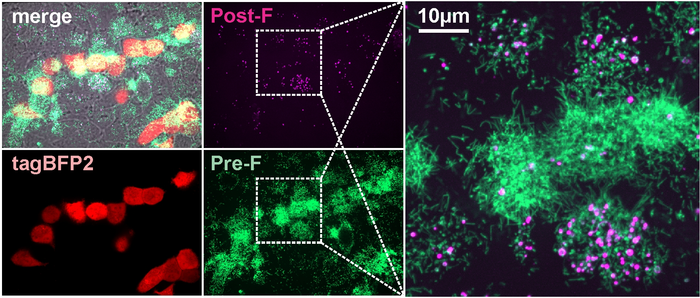 RSV particles [IMAGE] | EurekAlert! Science News Releases