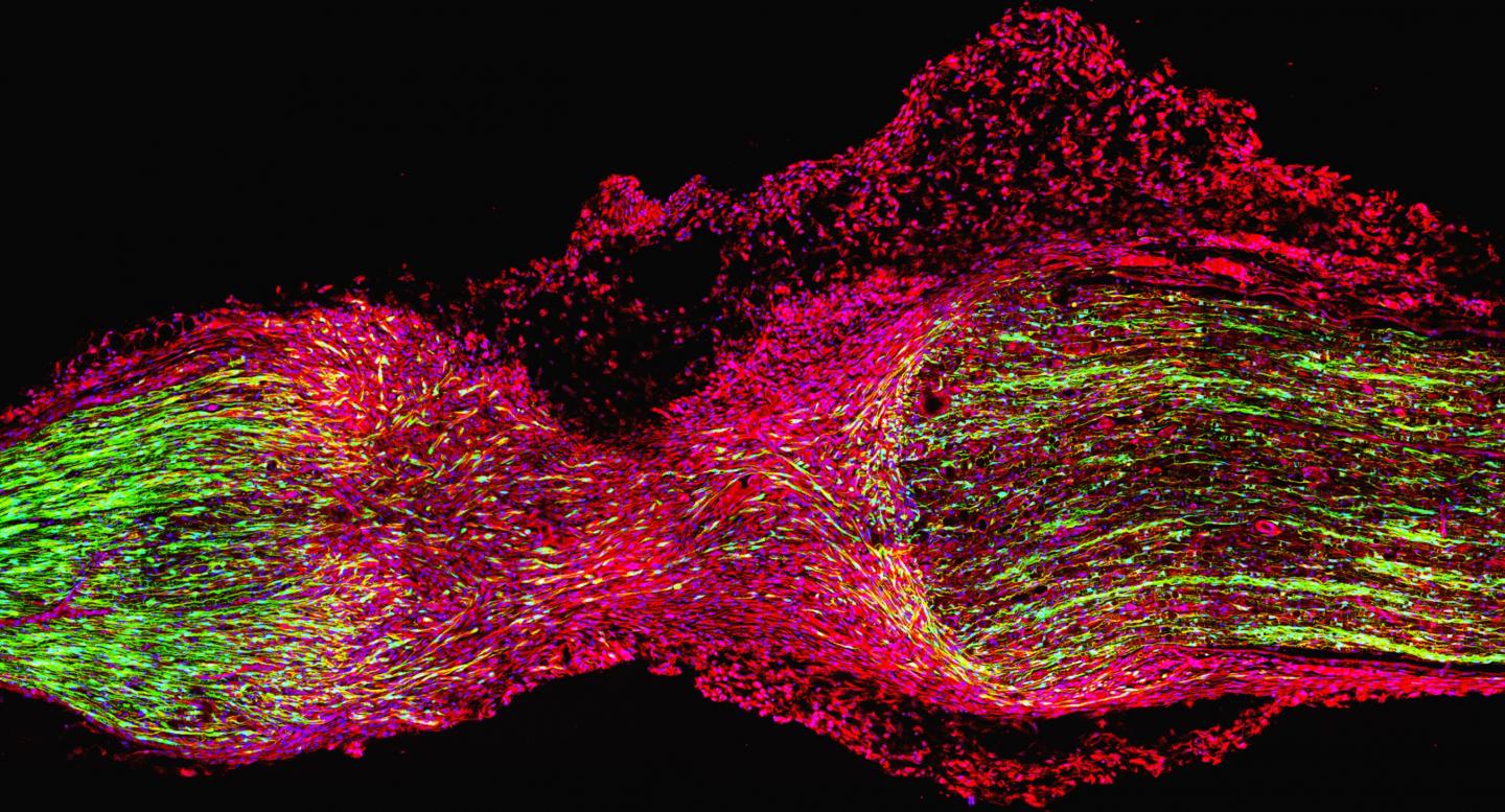 Nerve Bridge [IMAGE] | EurekAlert! Science News Releases