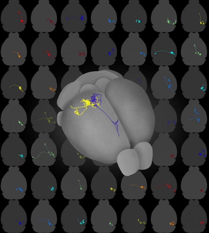 Single-Cell Projections from M [IMAGE] | EurekAlert! Science News Releases