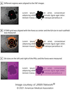 AMD: Reading ability crucial indicator of fun | EurekAlert!