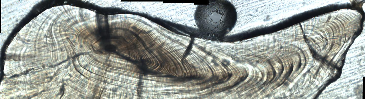 Otolith [IMAGE] | EurekAlert! Science News Releases