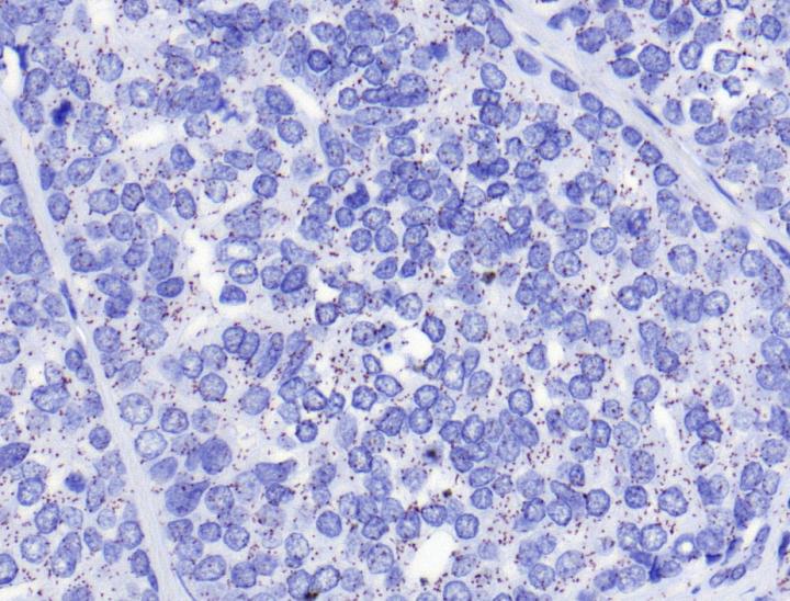 Unexpected Protein Modification Makes Prostat | EurekAlert!