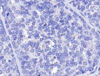 Unexpected Protein Modification Makes Prostat | EurekAlert!
