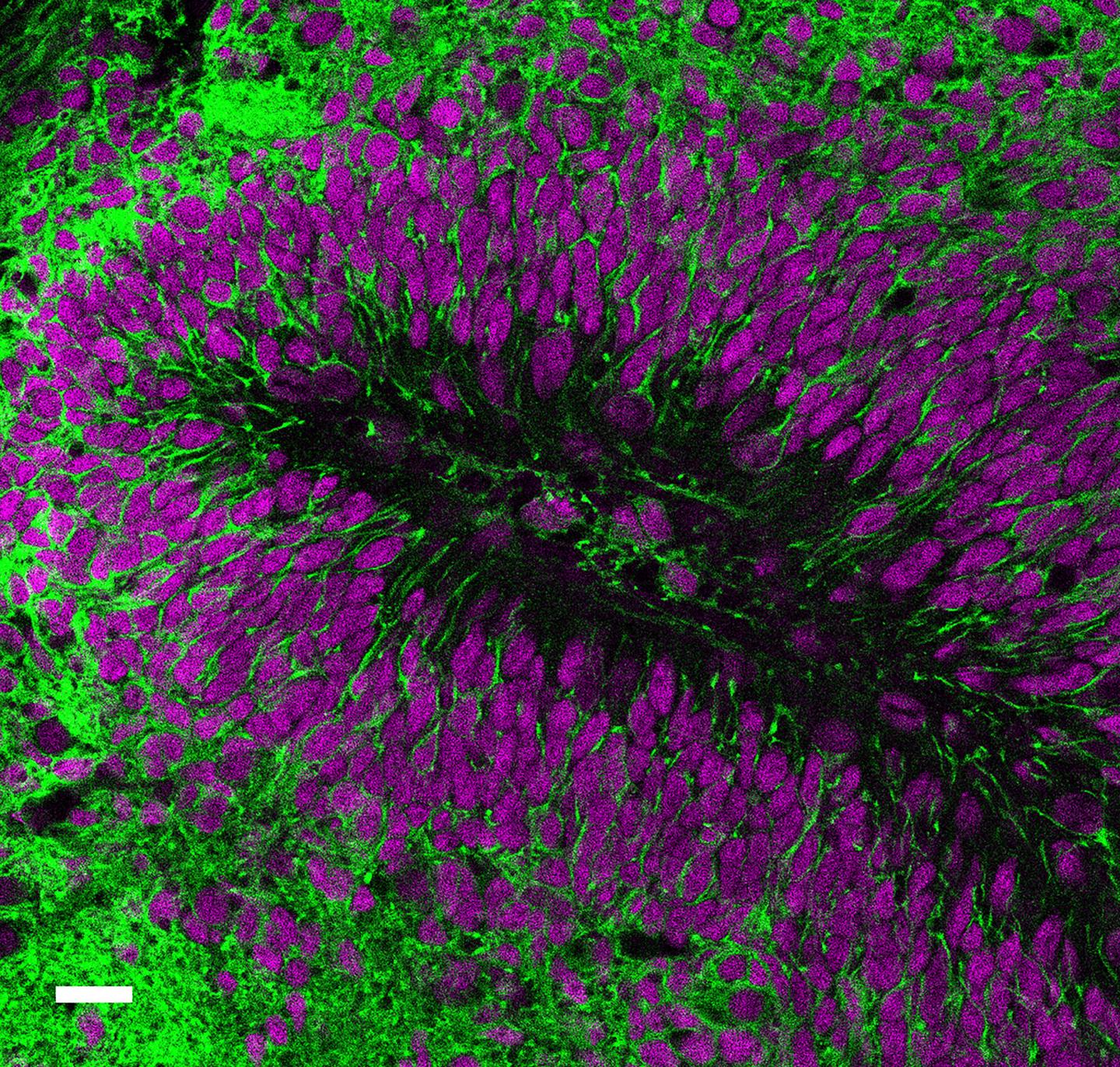 Neurons [IMAGE] | EurekAlert! Science News Releases