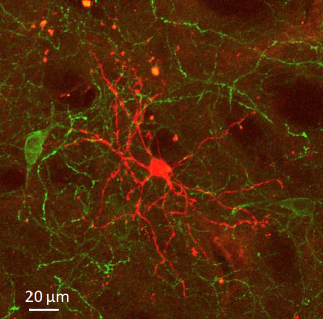 Neurons [IMAGE] | EurekAlert! Science News Releases