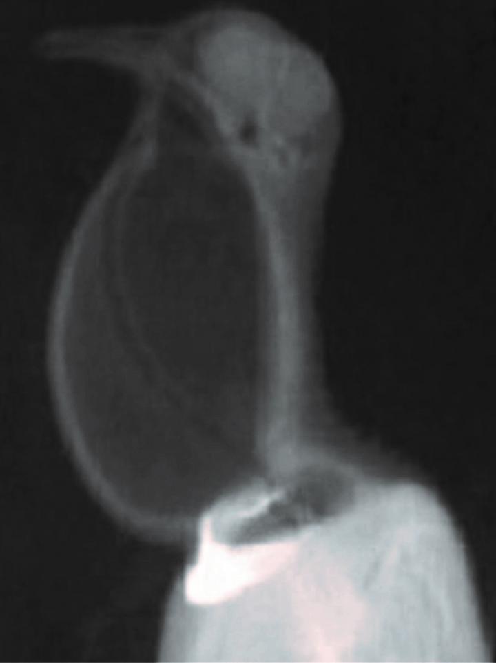 Dove X-ray [IMAGE] | EurekAlert! Science News Releases