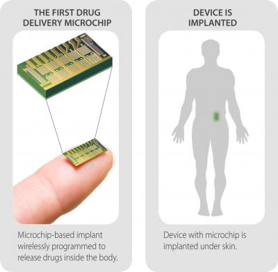 Implantable Microchip Delivers [IMAGE] | EurekAlert! Science News Releases
