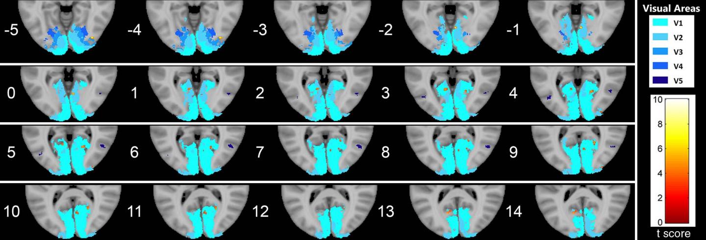 Figure 2 Series of Axial Secti [IMAGE] | EurekAlert! Science News Releases