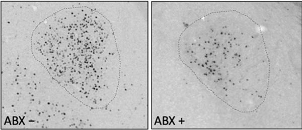 Rat Amygdala Pre- and Post-Ant [IMAGE] | EurekAlert! Science News Releases