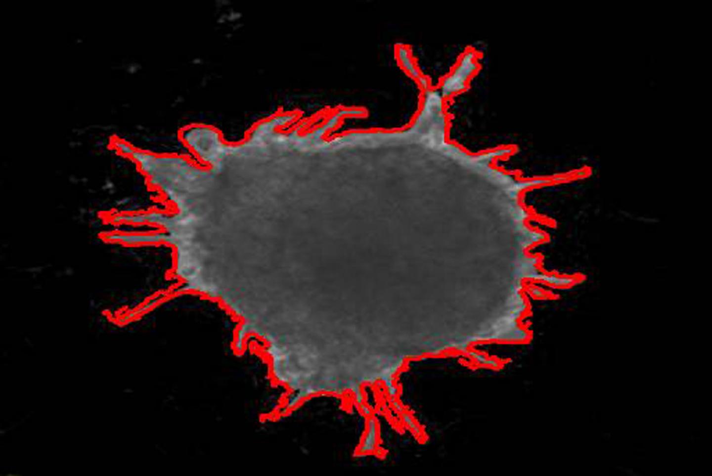 Cancer Cell Aggressiveness, Measured by Abili | EurekAlert!