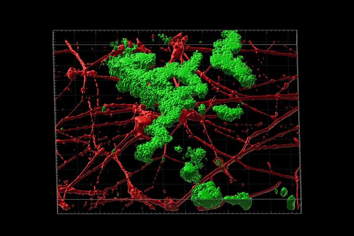 Amyloid beta plaque in neurons [IMAGE] | EurekAlert! Science News Releases