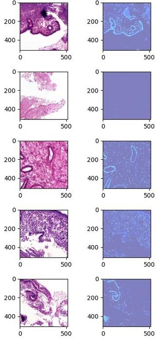 Focus map [IMAGE] | EurekAlert! Science News Releases