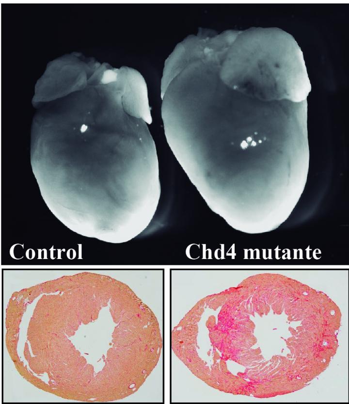 Chd4 [IMAGE] | EurekAlert! Science News Releases