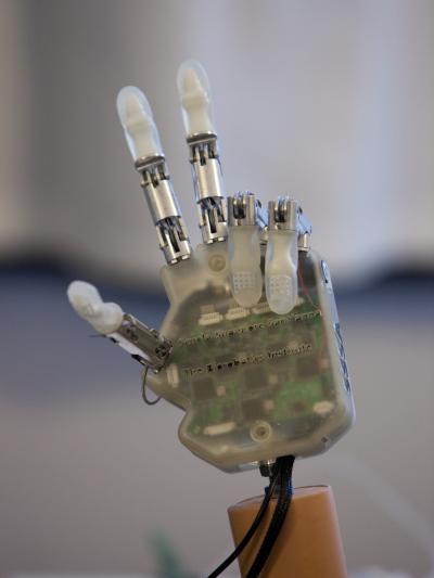 A 'Feeling' Prosthetic Hand (1 of 12) | EurekAlert!