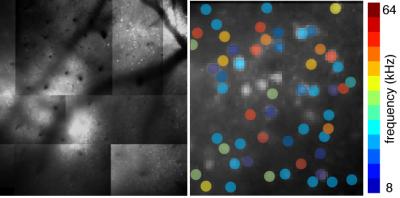 Auditory Cortex Cells [IMAGE] | EurekAlert! Science News Releases