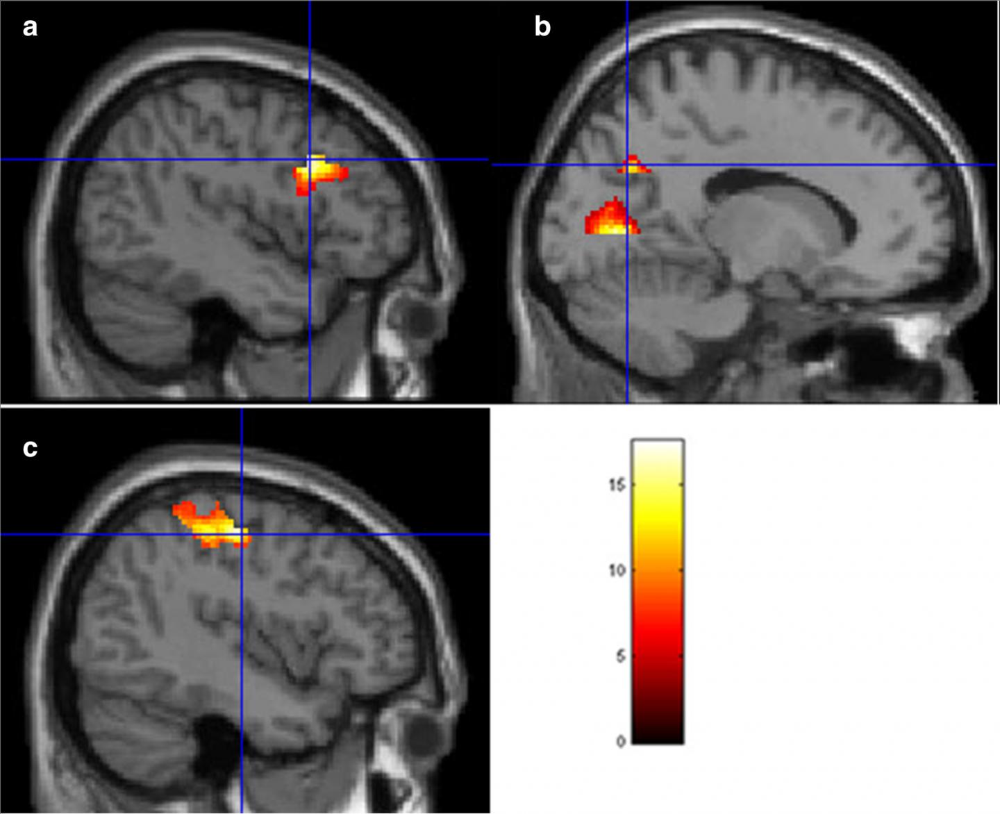 Brain Activity Following The M IMAGE EurekAlert Science News Releases