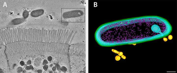 Bacteroides fragilis an [IMAGE] | EurekAlert! Science News Releases