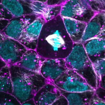 Alpha-tubulin Cell Division [IMAGE] | EurekAlert! Science News Releases