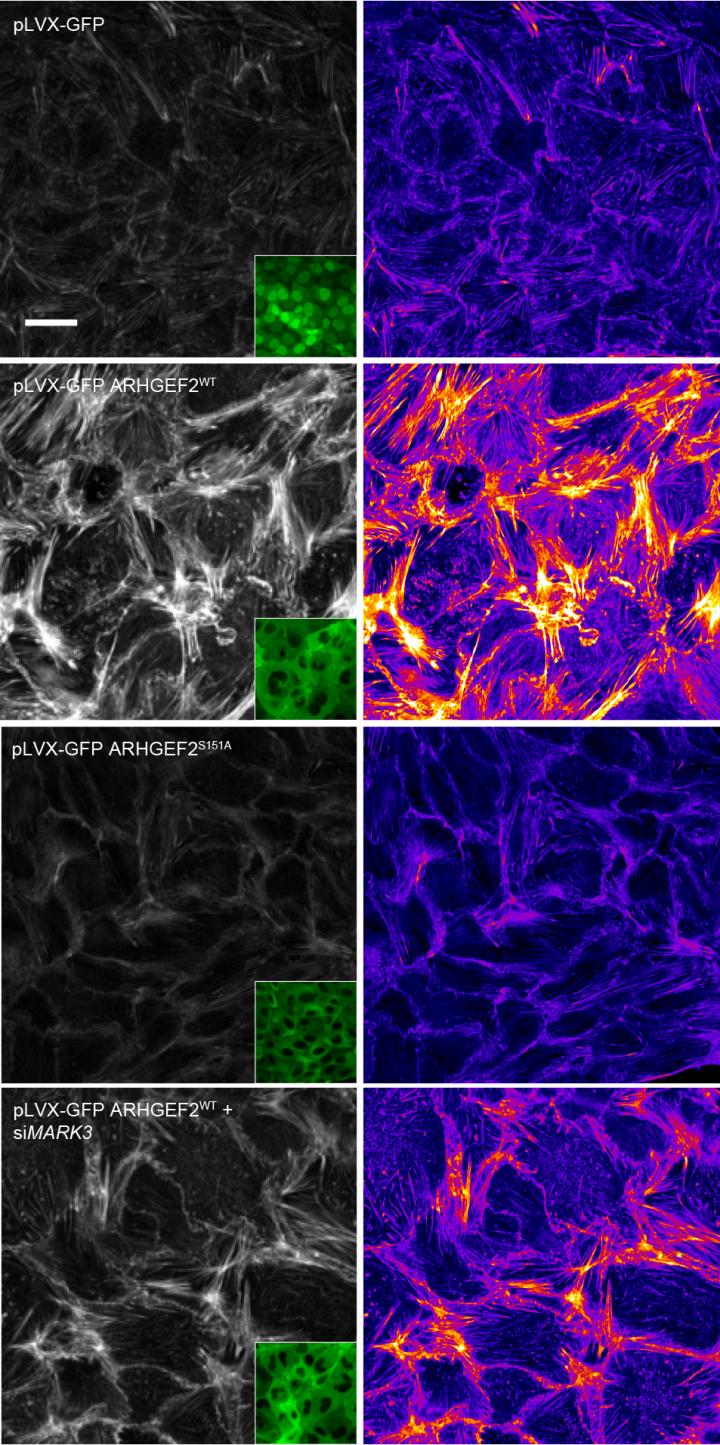 A Master Switch that Lets Cells Know Which Wa | EurekAlert!