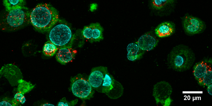 Extracellular vesicles [IMAGE] | EurekAlert! Science News Releases