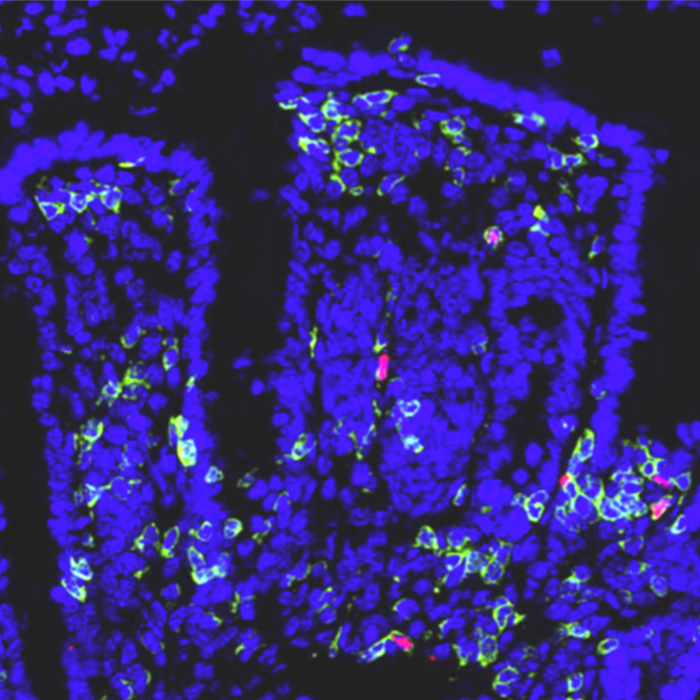 Treg [IMAGE] | EurekAlert! Science News Releases