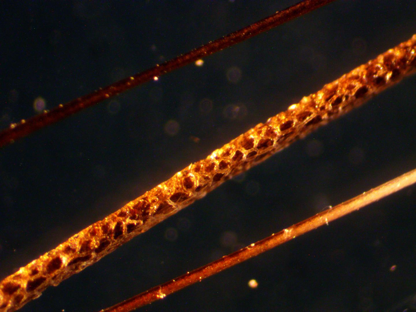 Regular and poison hairs [IMAGE] | EurekAlert! Science News Releases