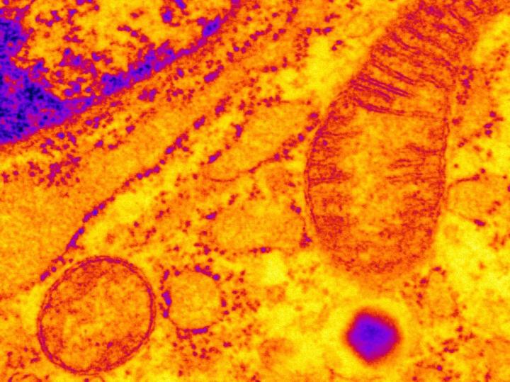 Microscope Image of a Pancreat [IMAGE] | EurekAlert! Science News Releases