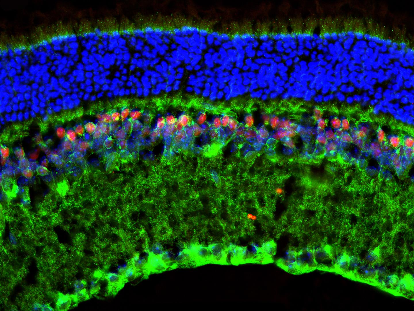 Mouse Retina [IMAGE] | EurekAlert! Science News Releases