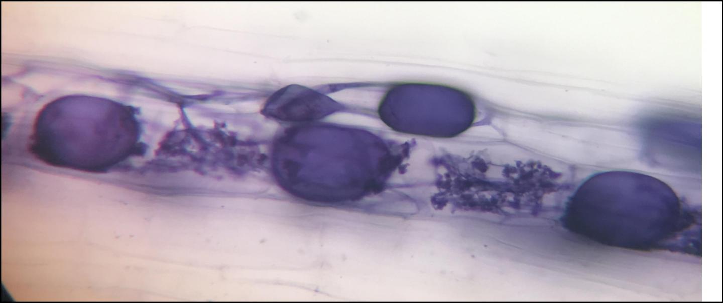 Fungi in Root [IMAGE] | EurekAlert! Science News Releases