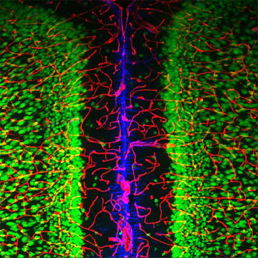 Mouse Brain [IMAGE] | EurekAlert! Science News Releases