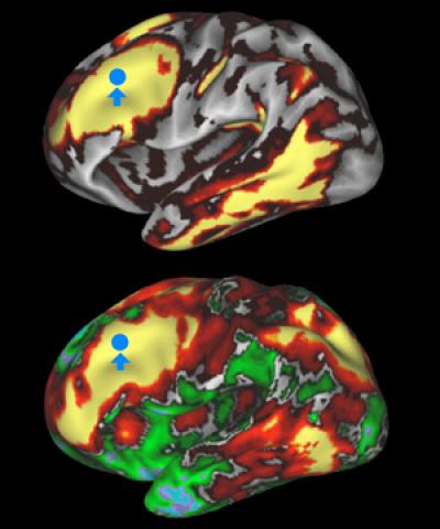 Connectome Brain Scans [IMAGE] | EurekAlert! Science News Releases