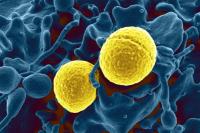 Treatment for S. aureus skin infection works | EurekAlert!
