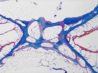 Histological Cut [IMAGE] | EurekAlert! Science News Releases