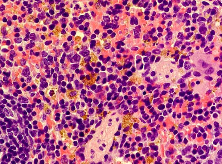 Hemosiderin [IMAGE] | EurekAlert! Science News Releases