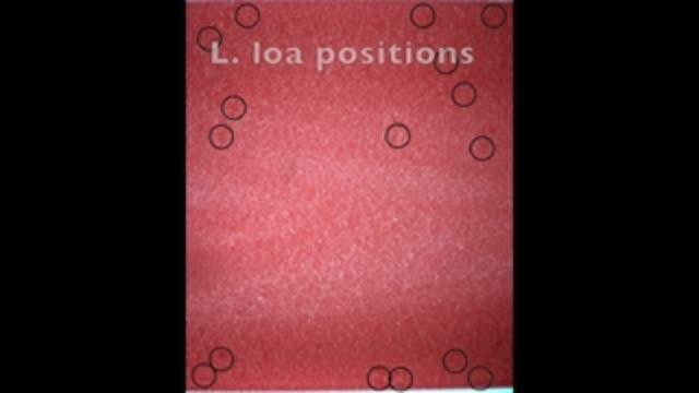 Mobile phone video microscope automates detec | EurekAlert!