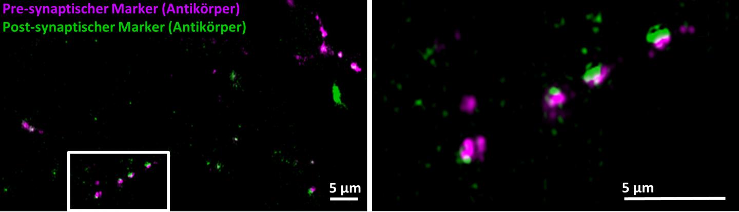 Fluorescent Synapses [IMAGE] | EurekAlert! Science News Releases