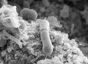 Scientists discover superbug's rapid path to | EurekAlert!